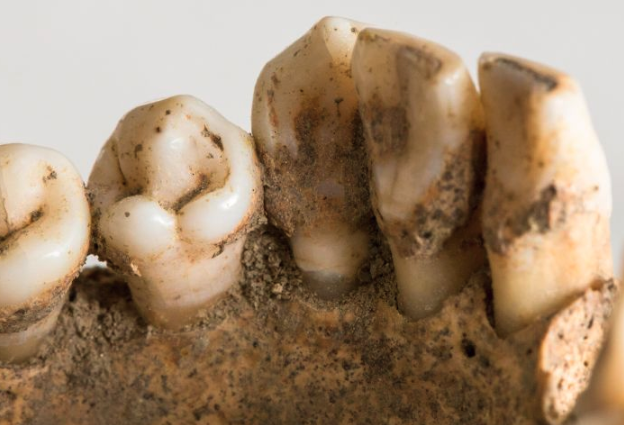 PREHISTORIC TEETH YIELD MEDICAL CLUES | Oxford Alumni